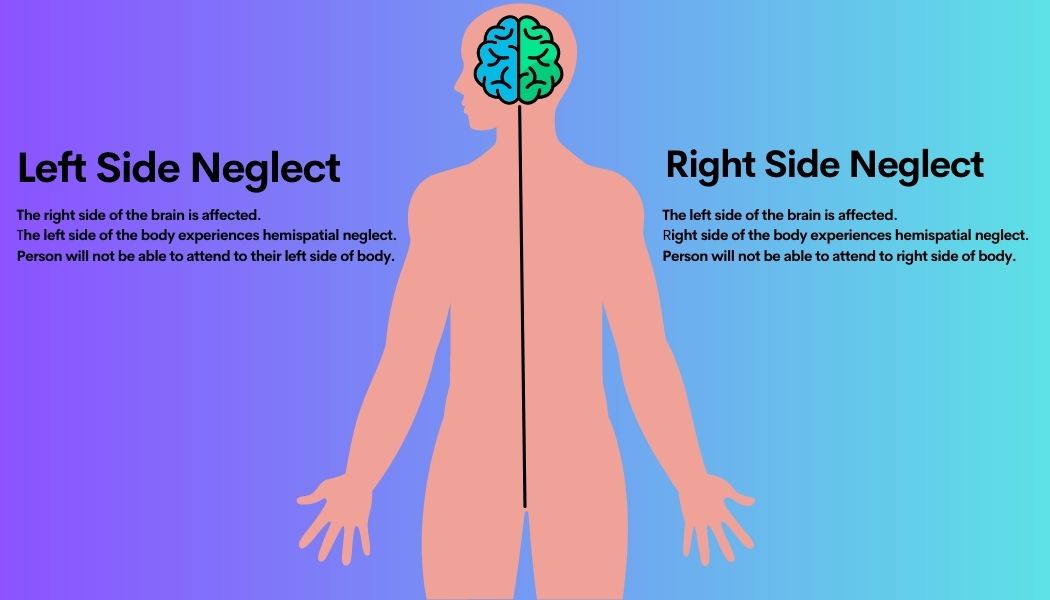 Life After Stroke: Understanding Common Impairments – OT Latina